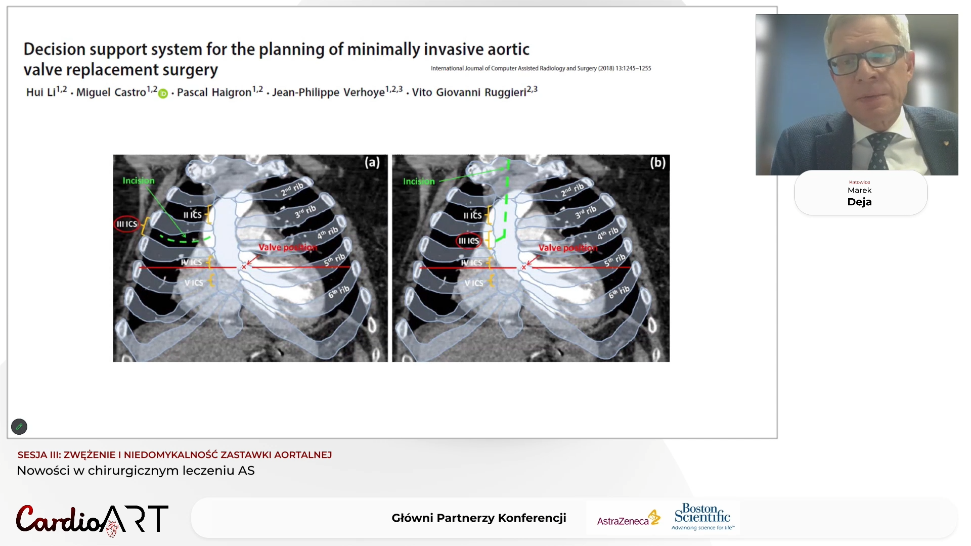 CardioART 2024: Interventional Cardiology for Clinical Artisans - SympoMed
